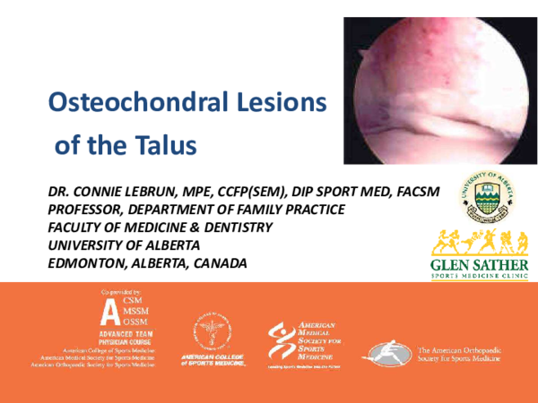 (PDF) Osteochondral lesions of the talus