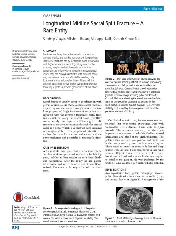 (PDF) Longitudinal Midline Sacral Split Fracture – A Rare Entity
