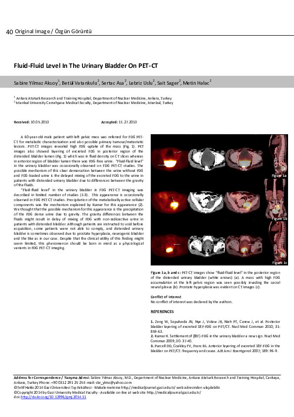 (PDF) Fluid-Fluid Level In The Urinary Bladder On PET-CT