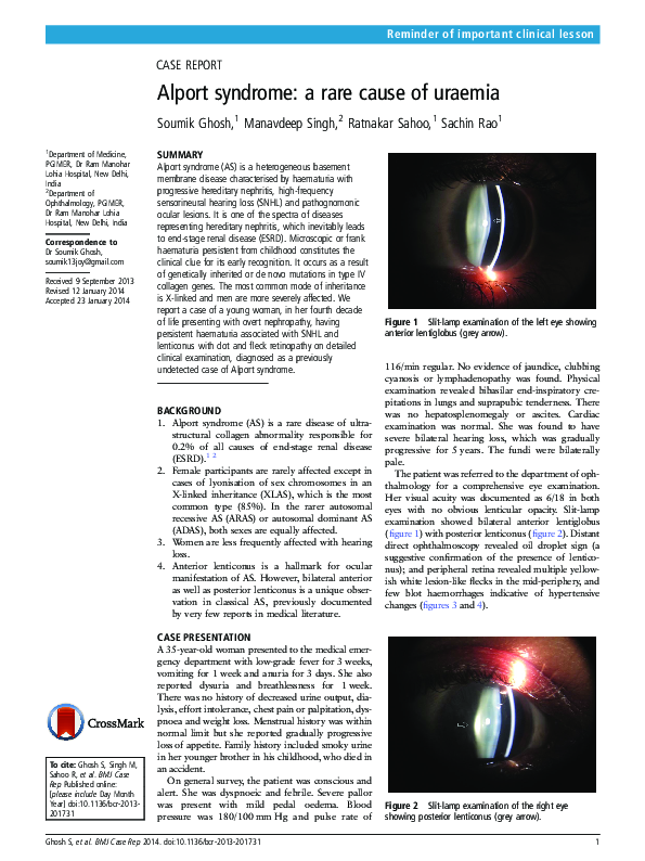 (PDF) Alport syndrome: a rare cause of uraemia