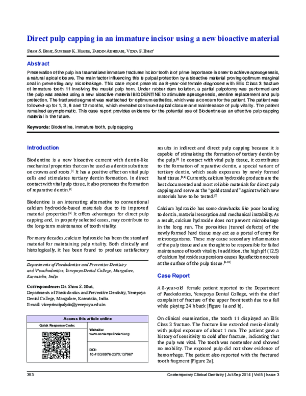 (PDF) Direct pulp capping in an immature incisor using a new bioactive ...