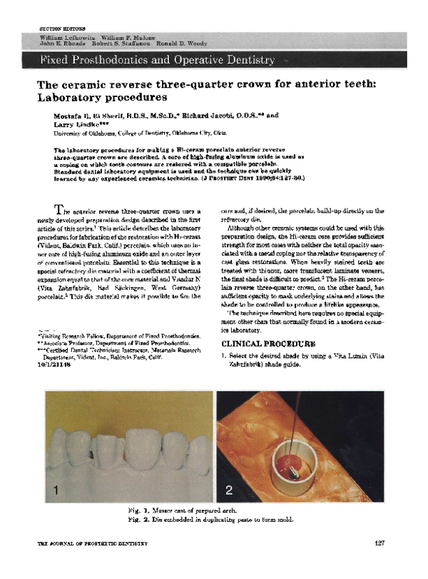 (PDF) The ceramic reverse three-quarter crown for anterior teeth ...