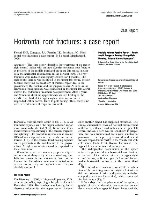 (PDF) Horizontal root fractures: a case report