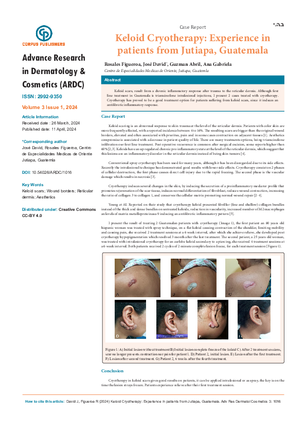 (PDF) Keloid Cryotherapy: Experience in patients from Jutiapa, Guatemala