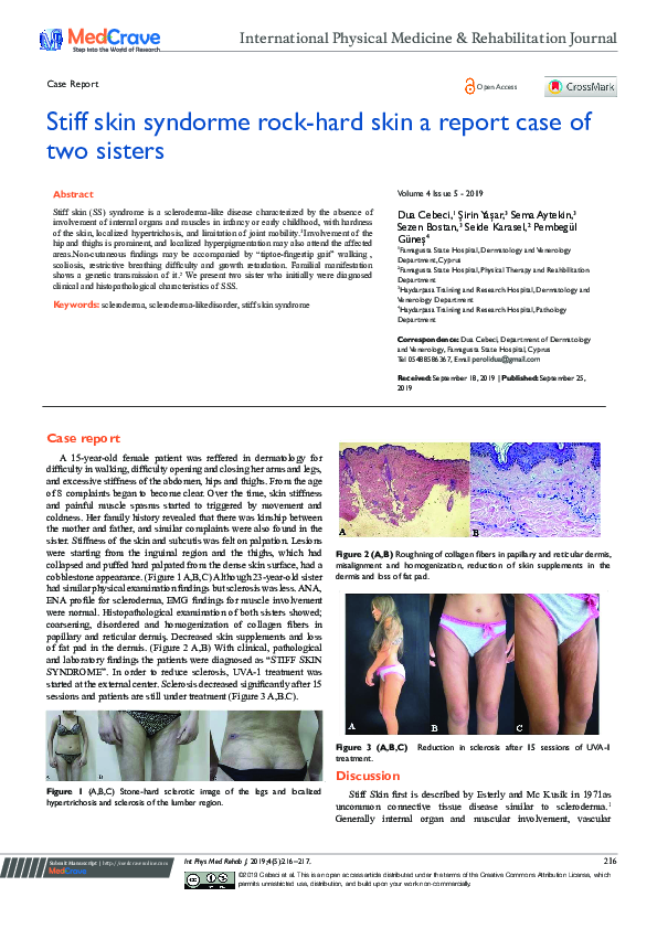 (PDF) Stiff skin syndorme rock-hard skin a report case of two sisters