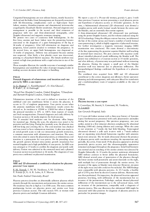 (PDF) P30.13: MRI and 3D ultrasound: a combined evaluation for placenta percreta? Case report ...