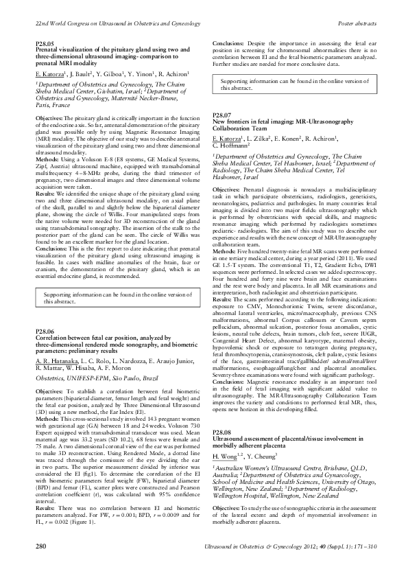 (PDF) P28.06: Correlation between fetal ear position, analyzed by three ...