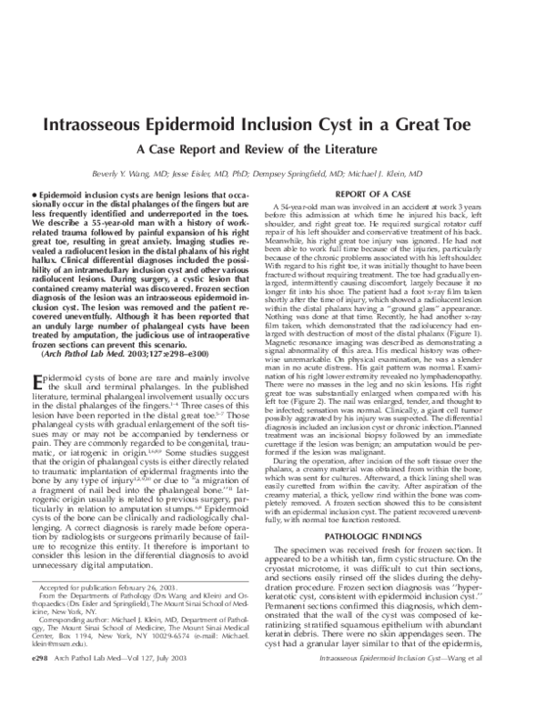 (PDF) Intraosseous Epidermoid Inclusion Cyst in a Great Toe | Jesse ...