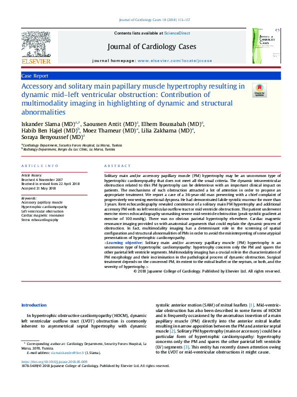 (PDF) Accessory and solitary main papillary muscle hypertrophy ...