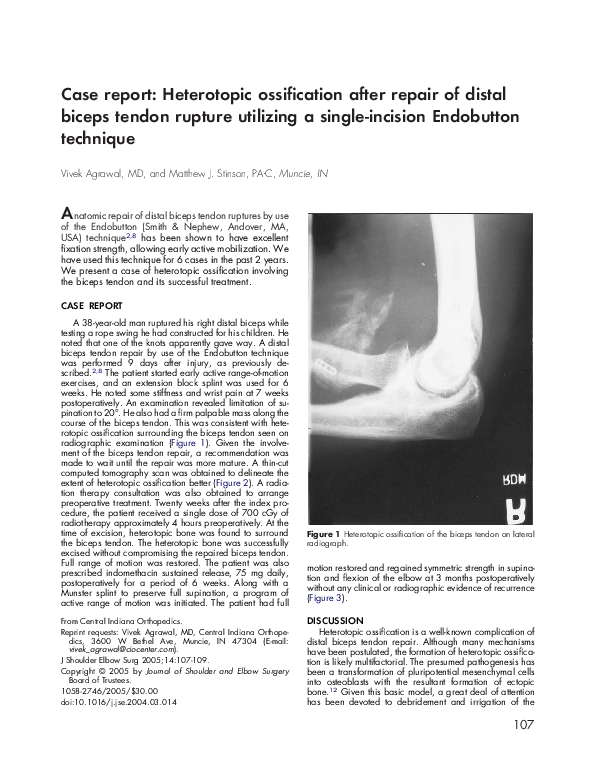 (PDF) Case report: Heterotopic ossification after repair of distal ...