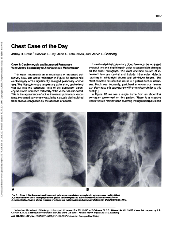(PDF) Chest case of the day