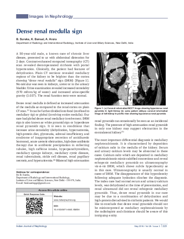 (PDF) Dense renal medulla sign