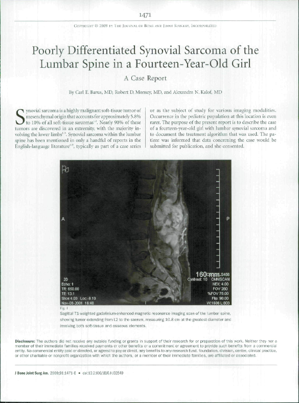 (PDF) Poorly differentiated synovial sarcoma of the lumbar spine in a ...