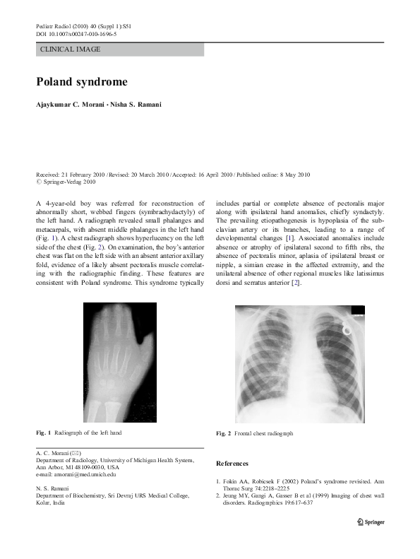 (PDF) Poland syndrome
