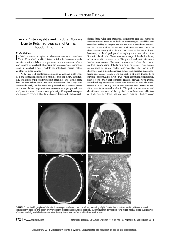 (PDF) Chronic Osteomyelitis and Epidural Abscess Due to Retained Leaves ...