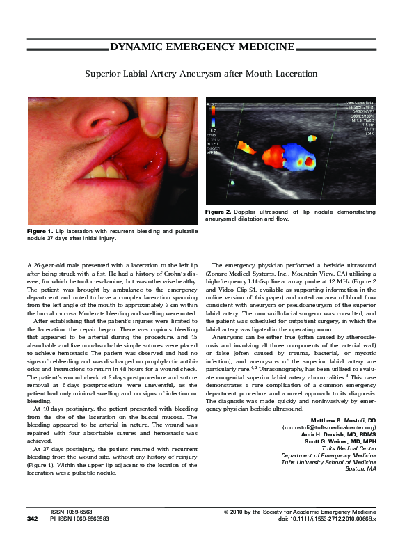 (PDF) Superior Labial Artery Aneurysm after Mouth Laceration