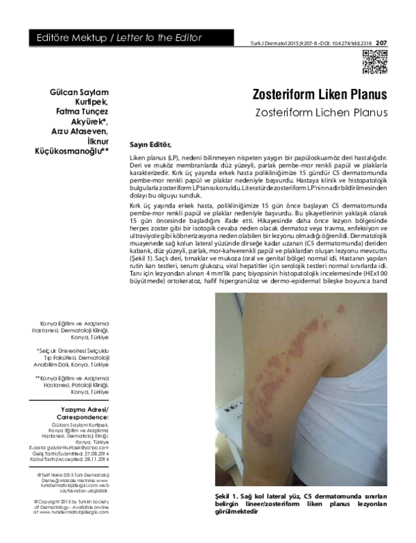 (PDF) Zosteriform Lichen Planus