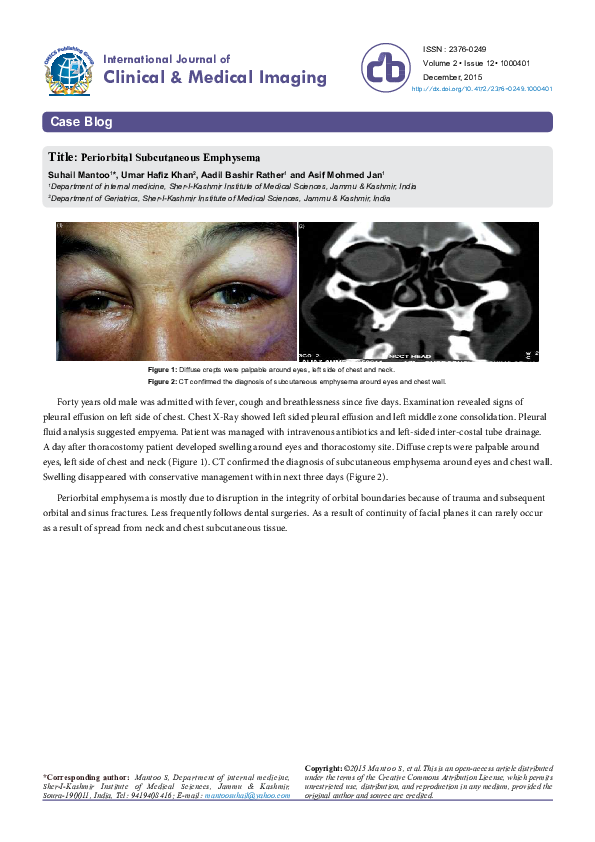 (PDF) Periorbital Subcutaneous Emphysema (PDF) Periorbital Subcutaneous Emphysema