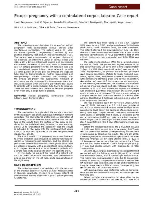 (PDF) Ectopic pregnancy with a contralateral corpus luteum: Case report
