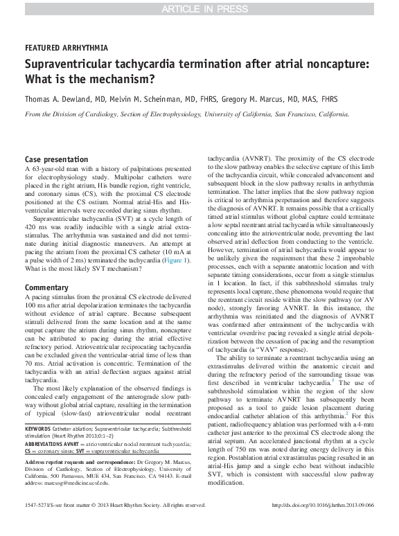 (PDF) Supraventricular tachycardia termination after atrial noncapture: what is the mechanism ...