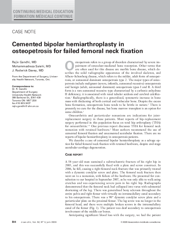 (PDF) Cemented bipolar hemiarthroplasty in osteoporosis for failed ...