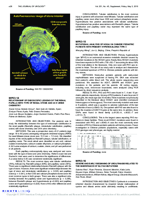 (PDF) MP03-16 SEVERE and Early Beginning of Urolithiasis Related to the ...