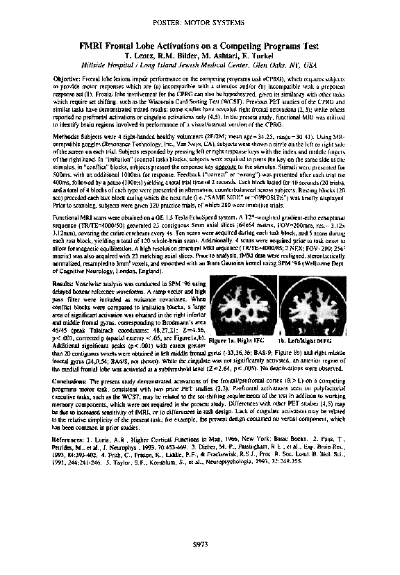 (PDF) FMRI Frontal Lobe Activations on a Competing Programs Test