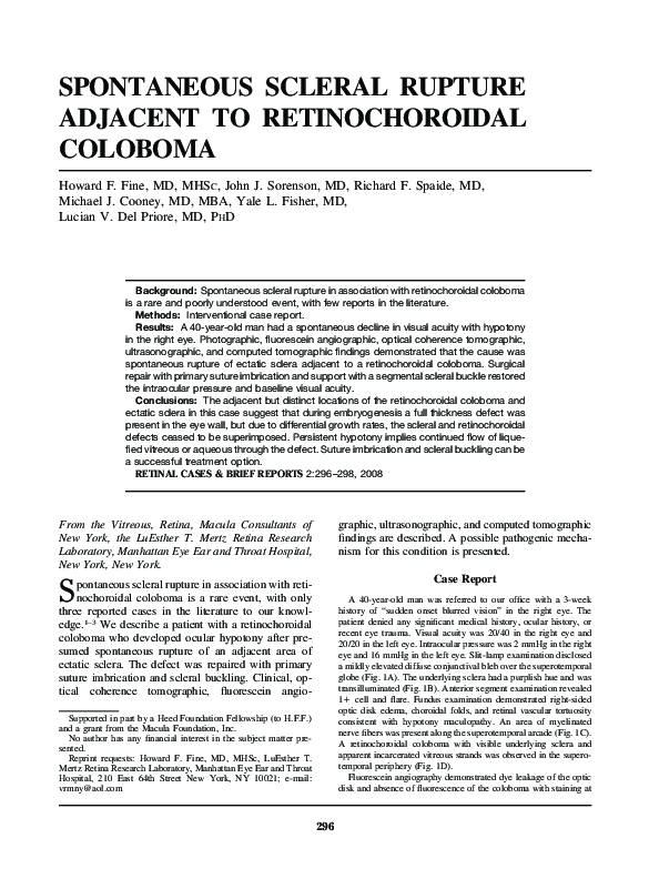 (PDF) Spontaneous Scleral Rupture Adjacent to Retinochoroidal Coloboma