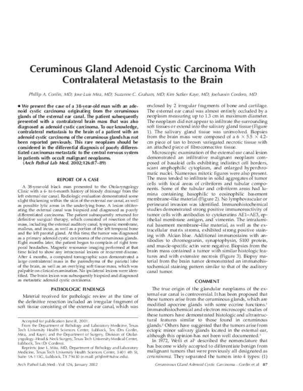 (PDF) Ceruminous gland adenoid cystic carcinoma with contralateral ...