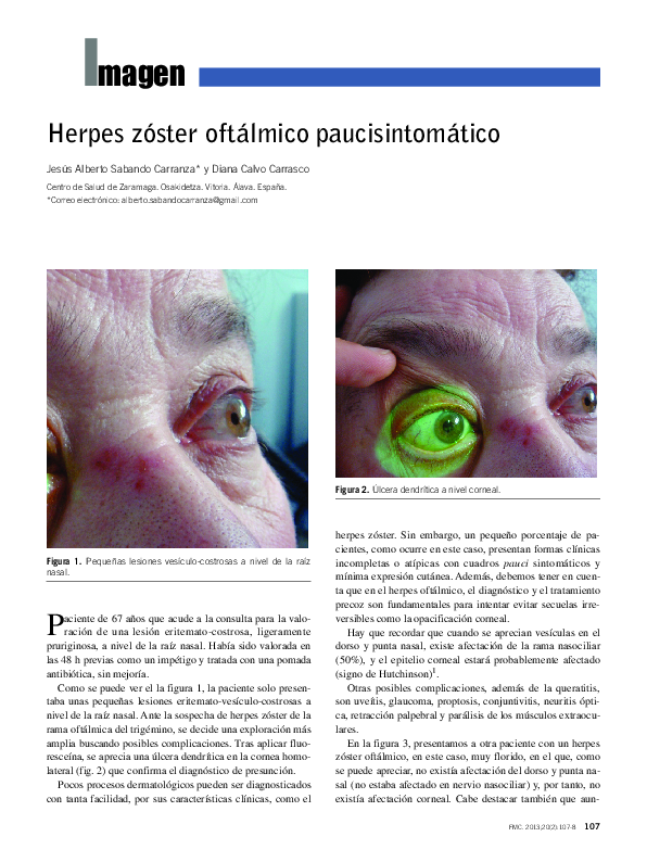 (PDF) Herpes zóster oftálmico paucisintomático | Diana lorena Carrasco - Academia.edu