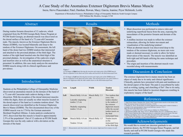 (PDF) A Case Study of the Anomalous Extensor Digitorum Brevis Manus