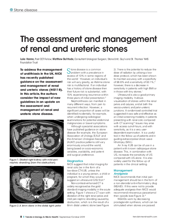 (PDF) The assessment and management of renal and ureteric stones