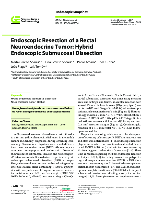 (PDF) Endoscopic Resection of a Rectal Neuroendocrine Tumor: Hybrid Endoscopic Submucosal Dissection