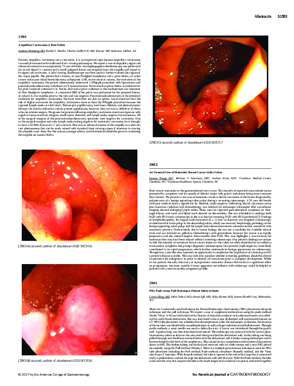 (PDF) PEG Push versus Pull Technique: Patient Safety at Stake