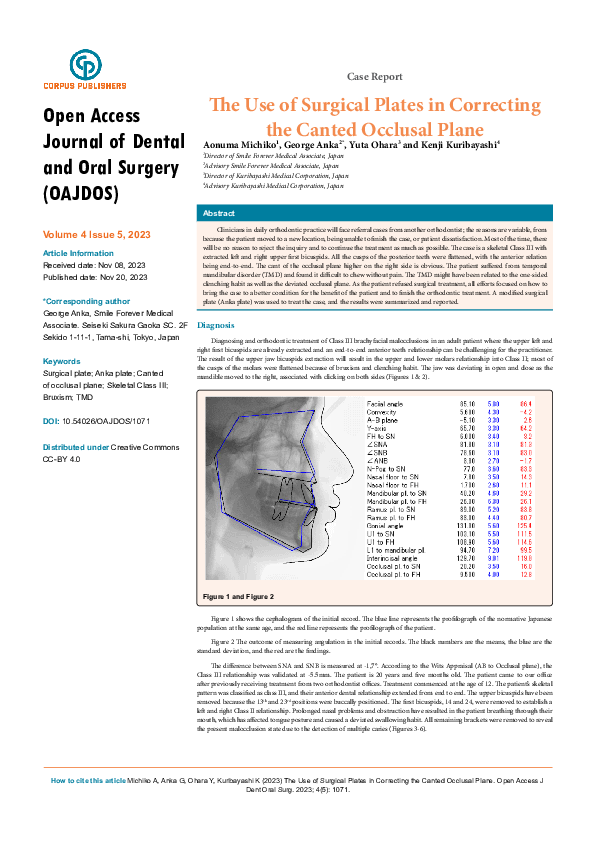 (PDF) The Use of Surgical Plates in Correcting the Canted Occlusal Plane