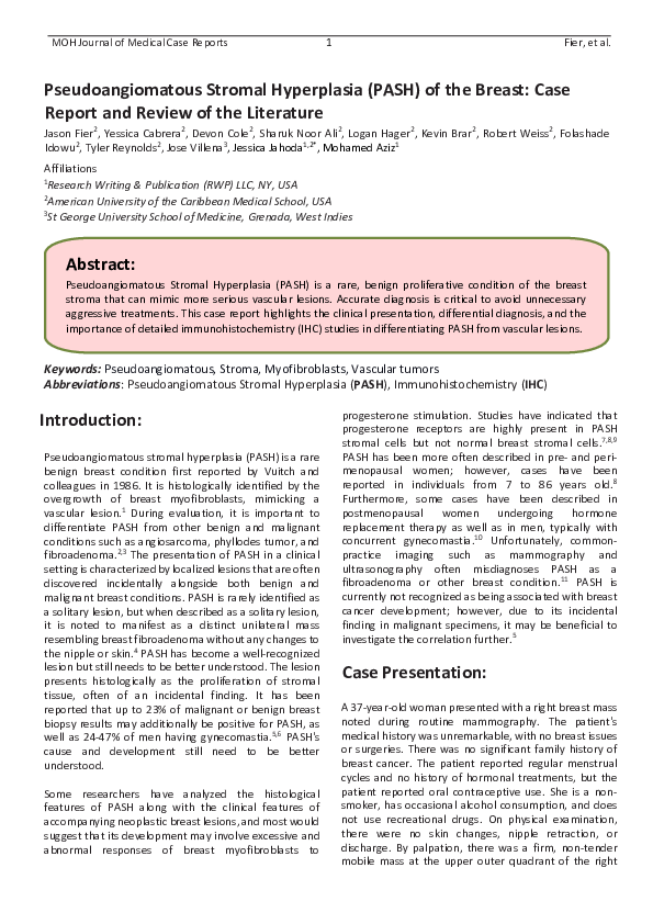 (PDF) Pseudoangiomatous Stromal Hyperplasia (PASH) of the Breast: Case ...