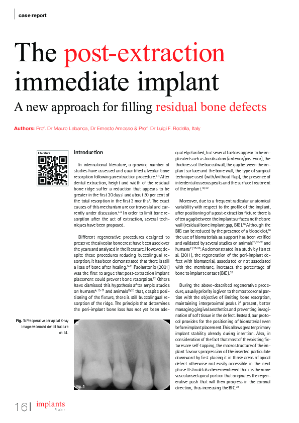 (PDF) The post-extraction immediate implant A new approach for filling residual bone defects