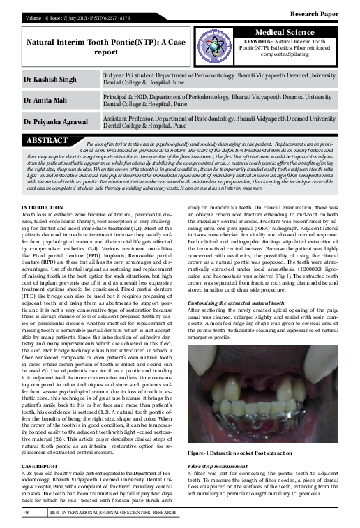(PDF) Natural Interim Tooth Pontic(NTP): A Case report