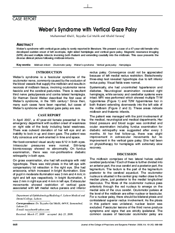 (PDF) Weber's syndrome with vertical gaze palsy