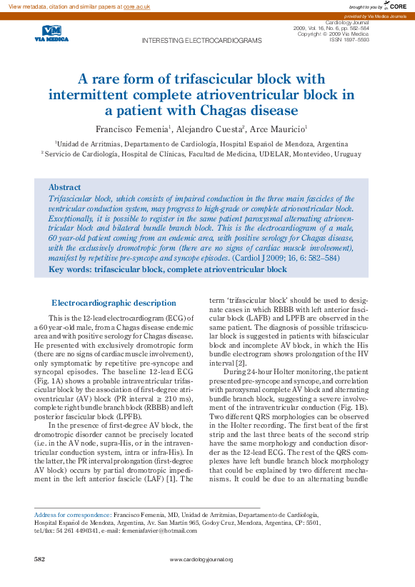 (PDF) A rare form of trifascicular block with intermittent complete ...