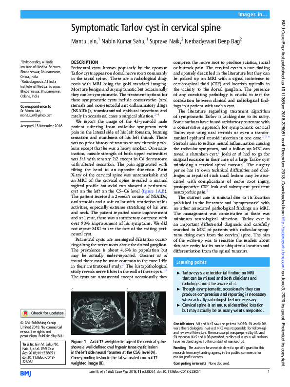 (PDF) Symptomatic Tarlov cyst in cervical spine