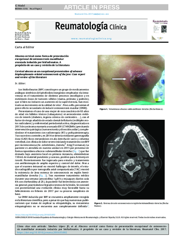 (PDF) Cervical abscess as an exceptional presentation of advance ...
