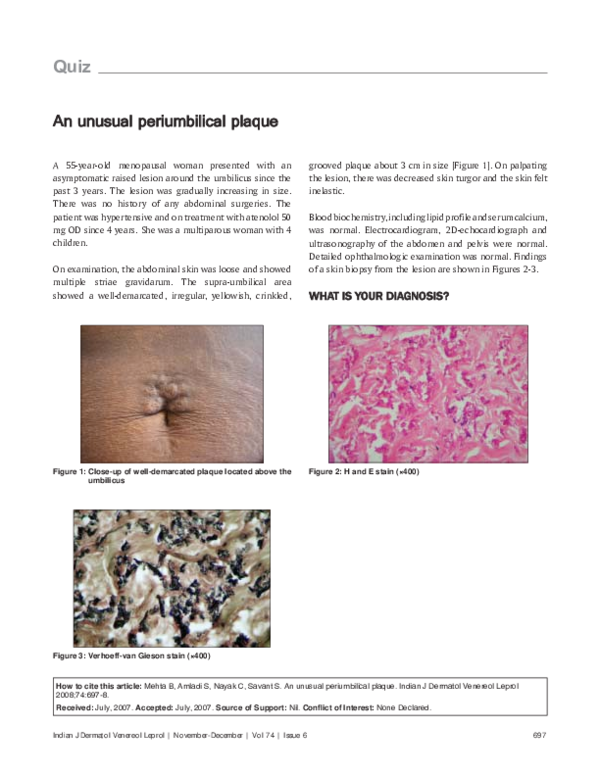 (PDF) An unusual periumbilical plaque