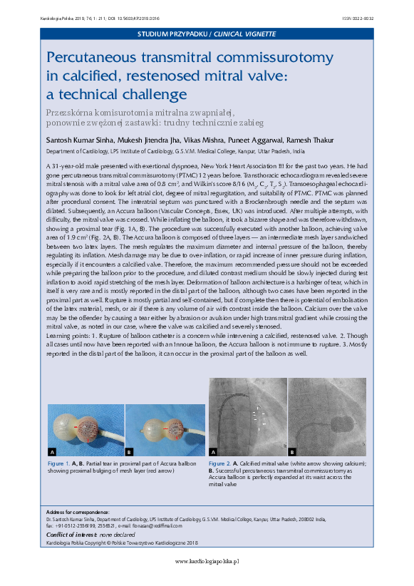 (PDF) Percutaneous transmitral commissurotomy in calcified, restenosed ...