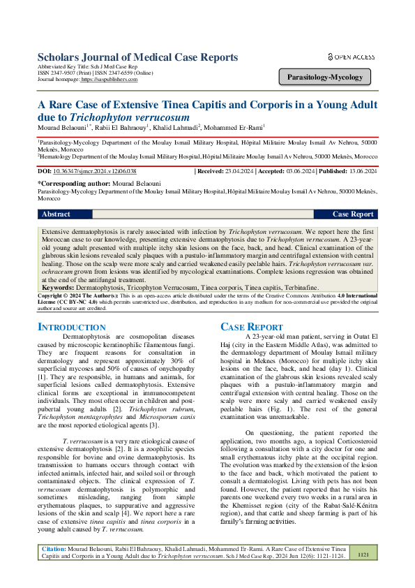 (PDF) A Rare Case of Extensive Tinea Capitis and Corporis in a Young ...