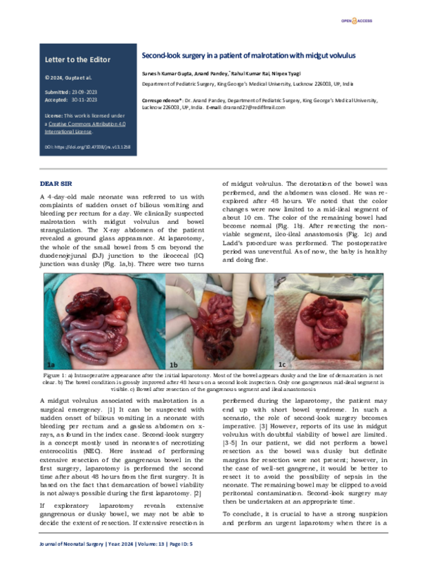 (PDF) Second-look surgery in a patient of malrotation with midgut volvulus