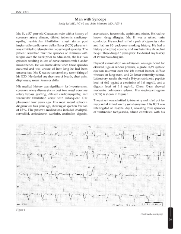 (PDF) Pulse: EKG-Man with Syncope