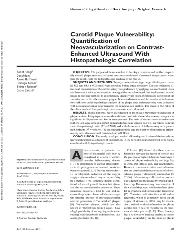 (PDF) Carotid Plaque Vulnerability: Quantification of Neovascularization on Contrast-Enhanced ...