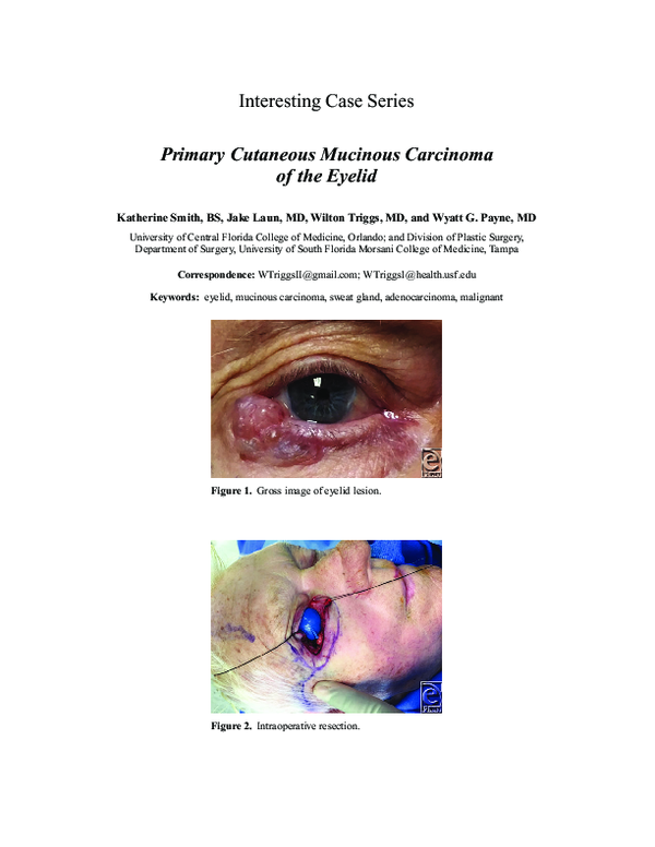 (PDF) Primary Cutaneous Mucinous Carcinoma of the Eyelid | Jake Laun ...