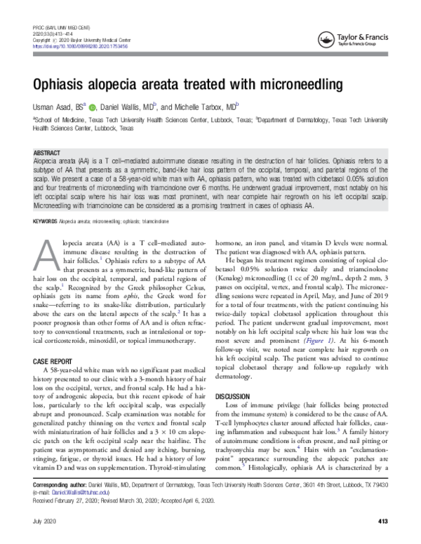 (PDF) Ophiasis alopecia areata treated with microneedling
